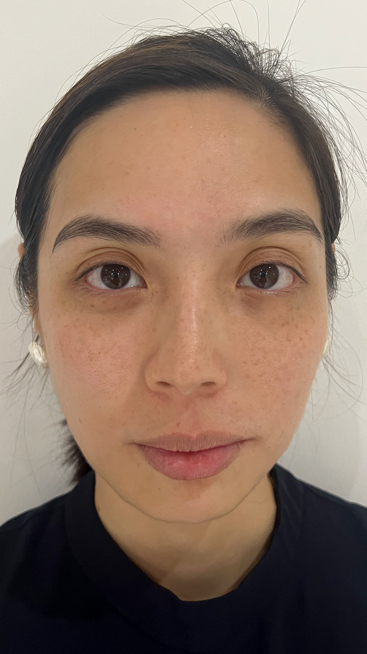 Skin & Facial Treatment Clinic in BGC, Taguig City - Wunderskin – Wunderskin PH