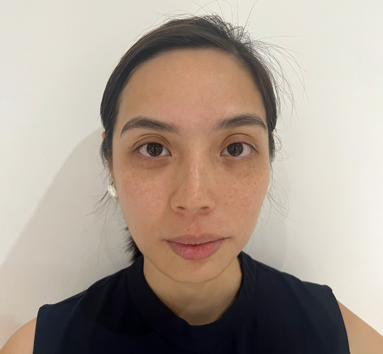 PicoSure Pro Laser – Wunderskin PH