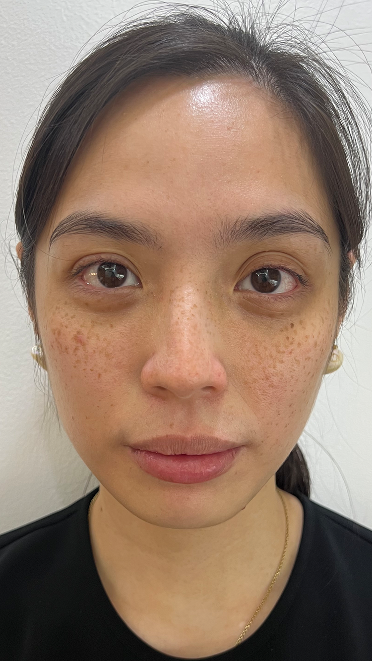 Skin & Facial Treatment Clinic in BGC, Taguig City - Wunderskin – Wunderskin PH